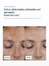 Hyperpigmentation Serum | Treatment for Dark Spots & Uneven Skin Tone ...