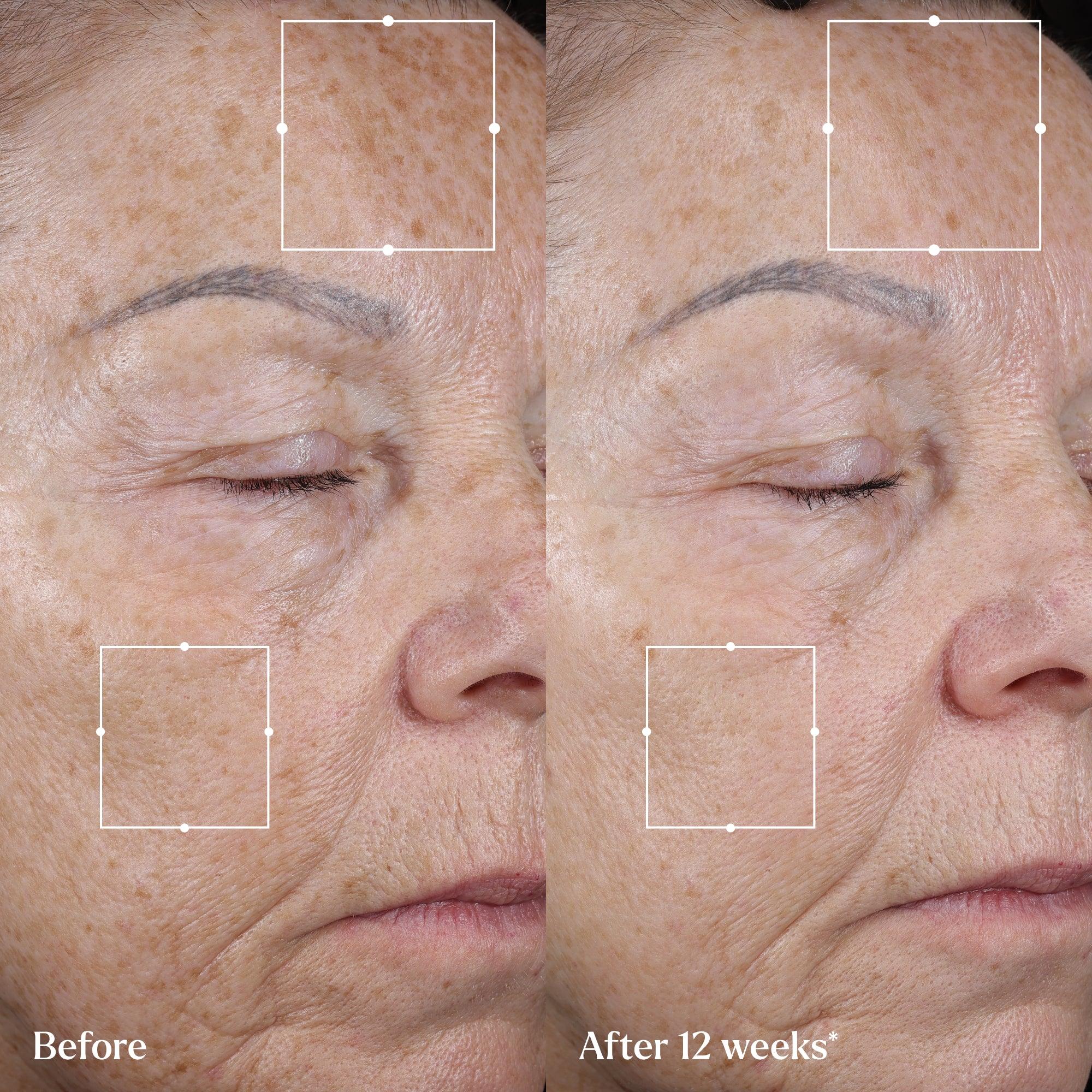 The Hyperpigmentation Serum | Skin Rocks by Caroline Hirons