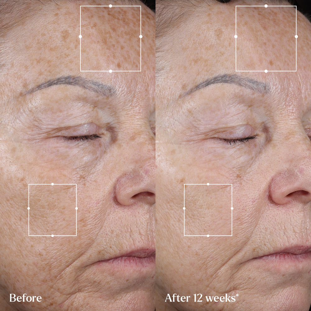 The Hyperpigmentation Serum | Skin Rocks by Caroline Hirons